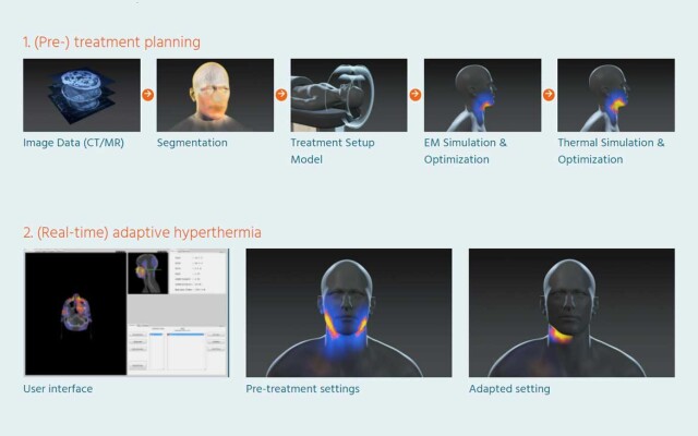 Adaptive Treatment | Sensius